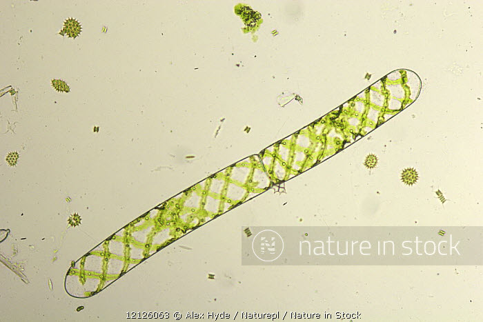 Spirogyra Under A Microscope Protists