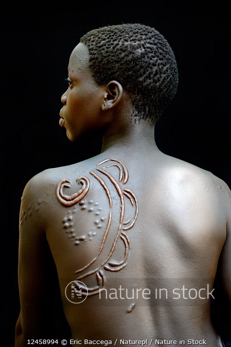 Scarification